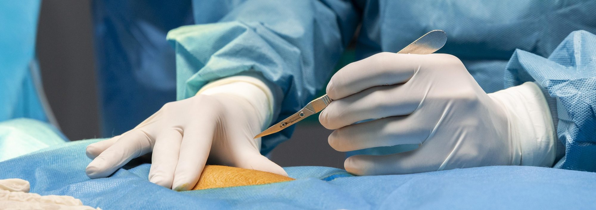 Abdominalna kirurgija - operacije hernija i žuči - Arithera